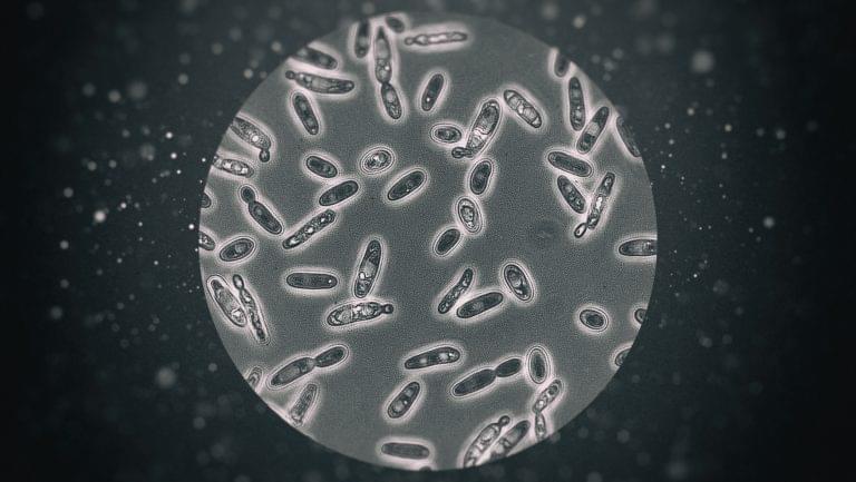 Your Ultimate Guide to Brettanomyces, Winemaking’s Most Polarizing ...